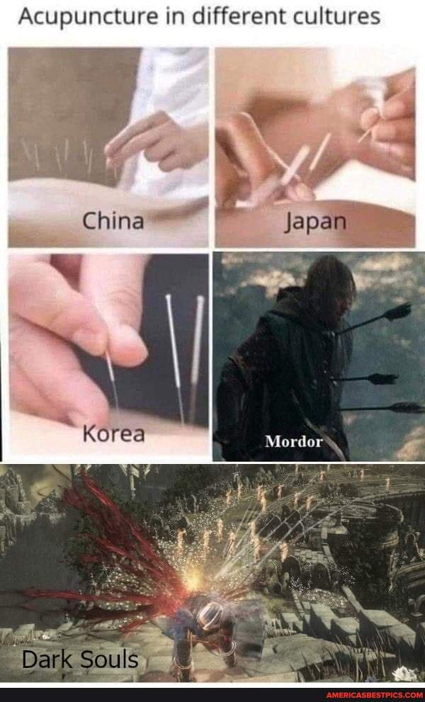 Acupuncture in different cultures China - America’s best pics and videos
