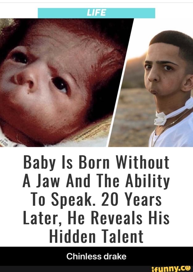 Baby Is Born Withdut A law And The Ability To Speak. 20 Years Later, He ...