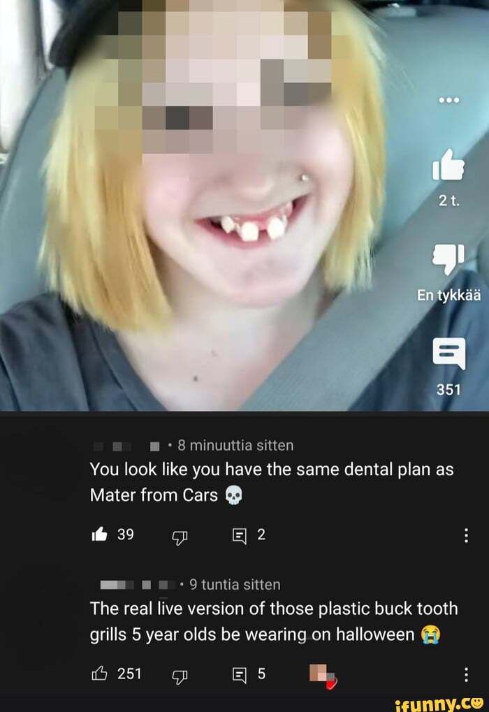 Real Buck Teeth