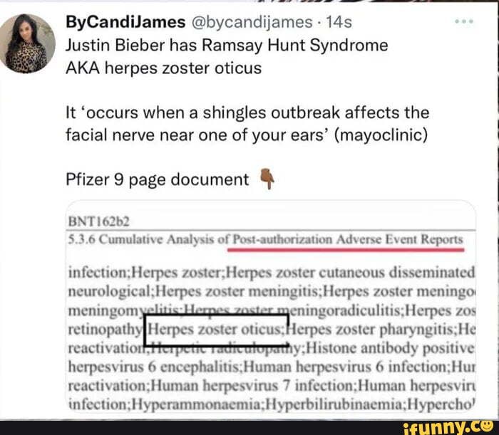 Shingles memes. Best Collection of funny Shingles pictures on iFunny