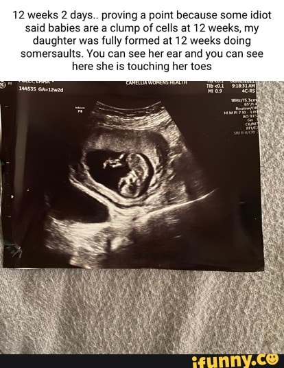 Somersaults memes. Best Collection of funny Somersaults pictures on iFunny