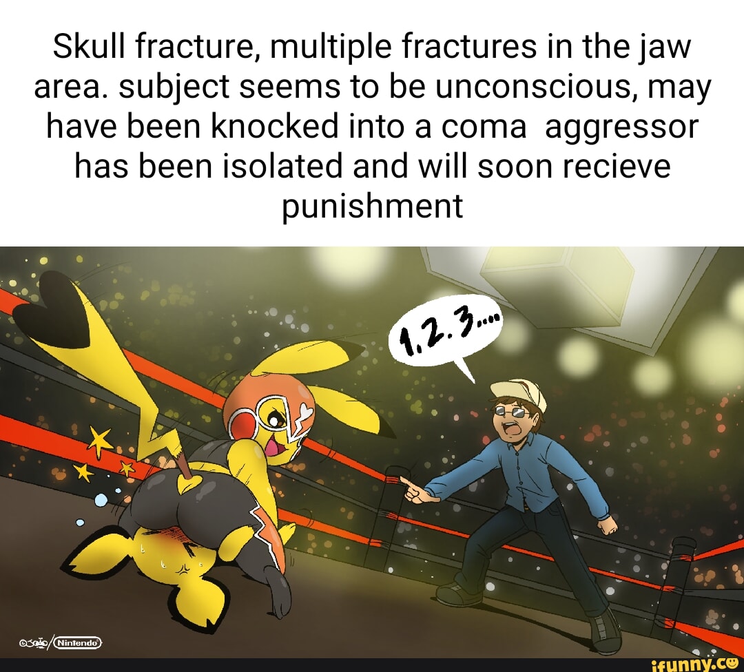 Skull fracture, multiple fractures in the jaw area. subject seems to be ...